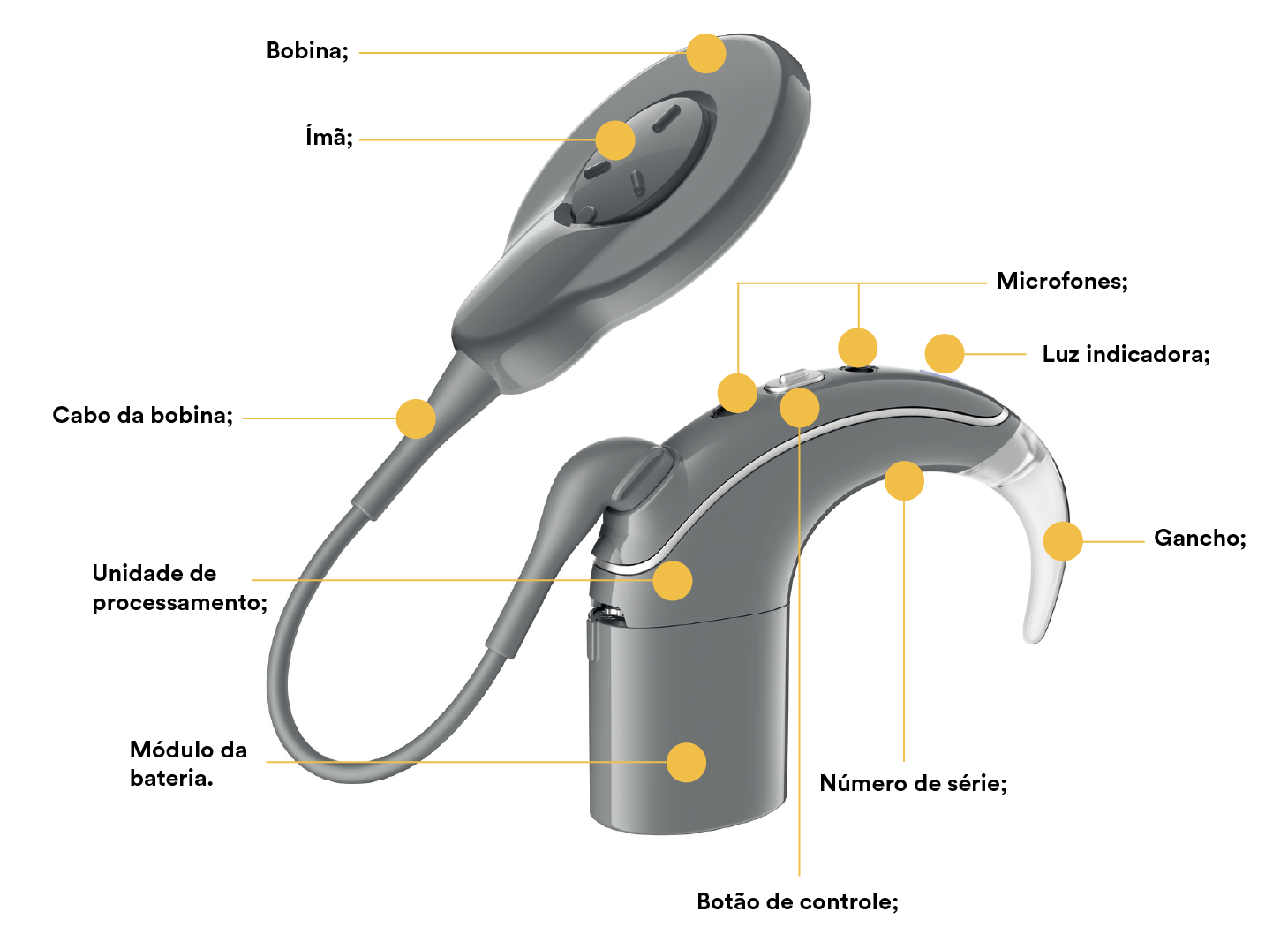 Assim é a tecnologia integrada a um implante coclear