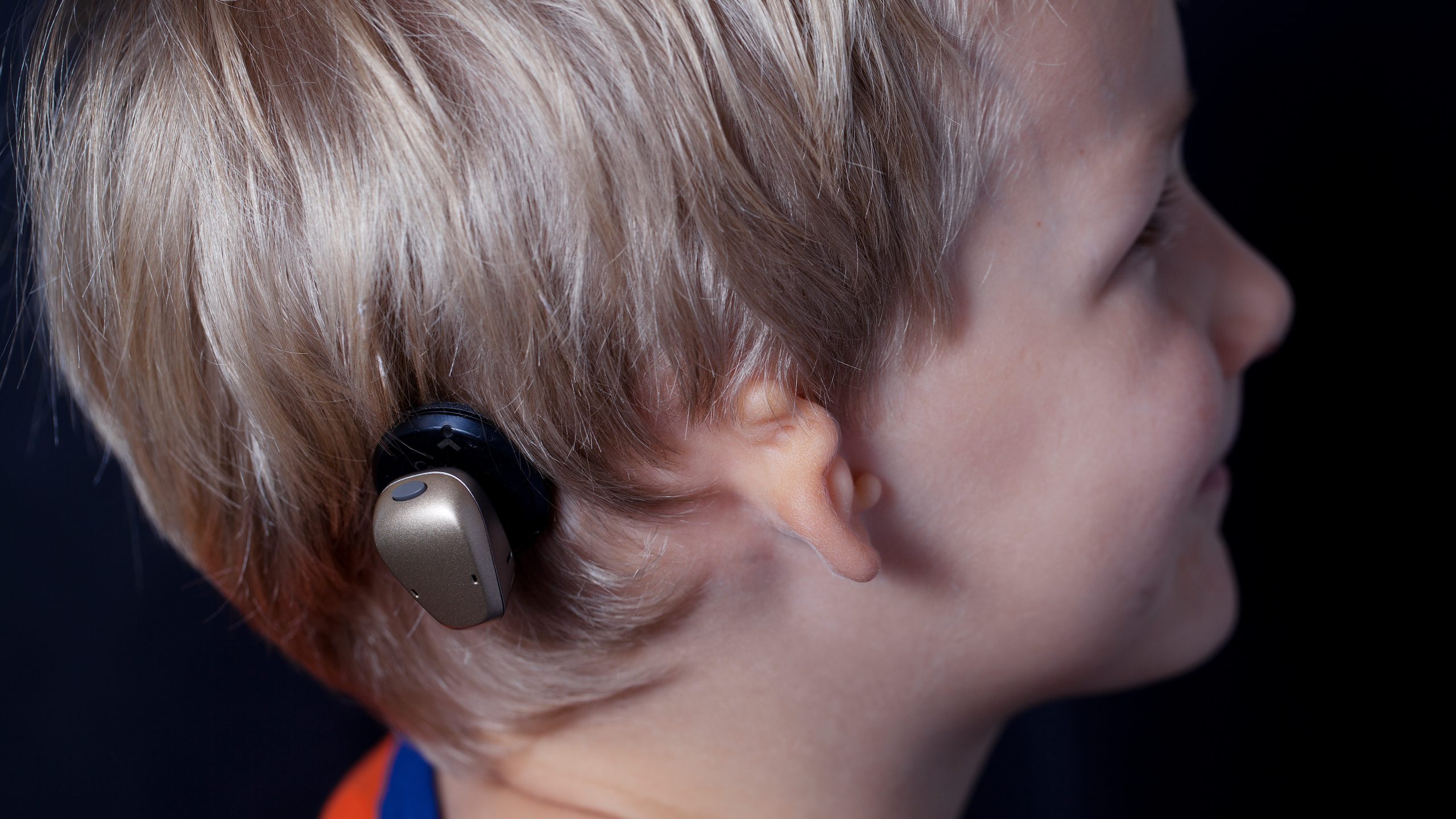 Dia Internacional da Microtia: Histórias que inspiram e transformam